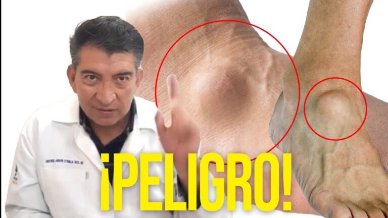 3 soluciones efectivas para tratar el incómodo bulto duro en el empeine ...