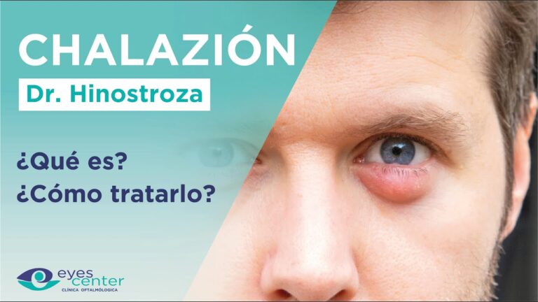 Bultos en el párpado superior del ojo: causas, tratamientos y consejos ...