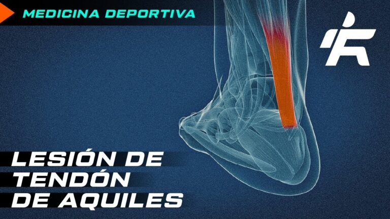 Tendón de Aquiles: Descubre Cómo se Regenera de Forma Natural y ...