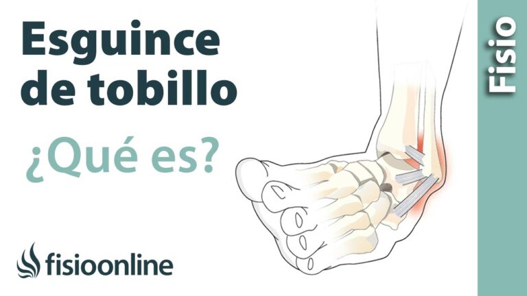 Explicación detallada: ¿Qué es una contusión en el tobillo y cómo ...