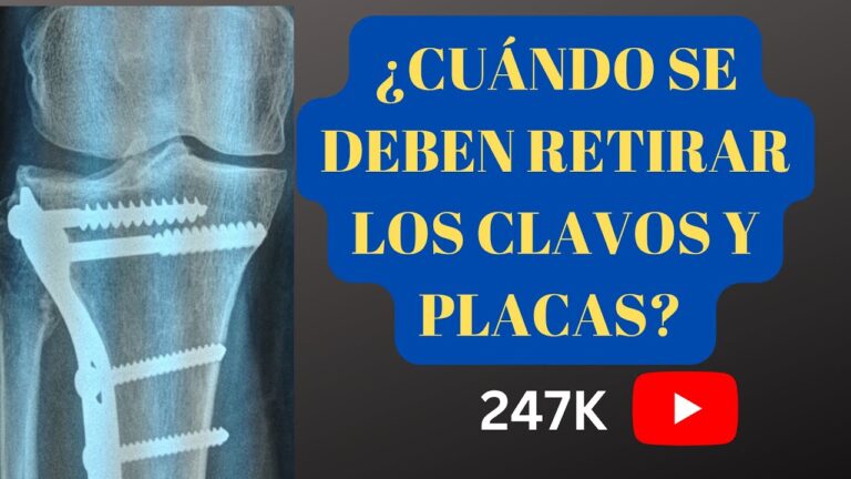 Descubre cómo acelerar tu recuperación después de una retirada de ...