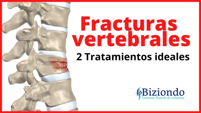 Guía completa: Cómo curar una fractura de vértebra lumbar y recuperar ...