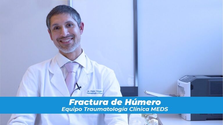 ¡Descubre el tiempo exacto de recuperación de una fractura de húmero y ...