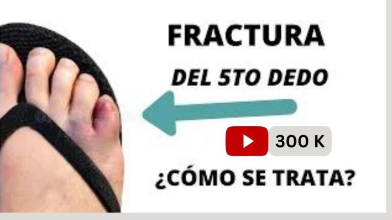 Dedo del pie hinchado por golpe: causas, síntomas y tratamiento eficaz ...