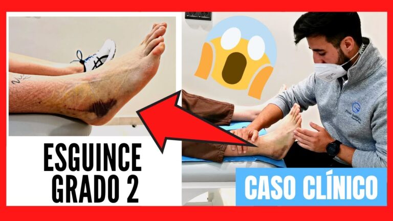 Recuperación de esguince de tobillo grado 2: Consejos y ejercicios para ...